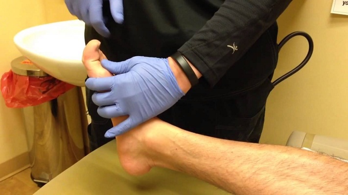 Dislocación de la articulación del pie: tipos, síntomas, signos y su ...