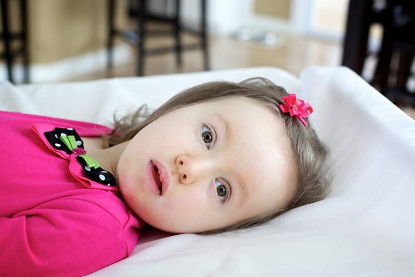 Enfermedad de Alexander: causas, síntomas, tratamiento, esperanza de vida