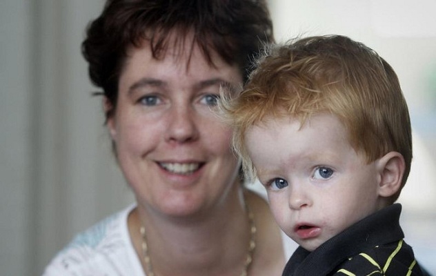 Qué es el Síndrome de Whistling Face: Causas, Síntomas, Tratamiento