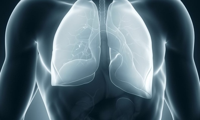 Qué es el mesotelioma pleural maligno: causas, signos y síntomas