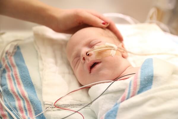 Qué es la enterocolitis necrosante: tratamiento, causas, síntomas ...