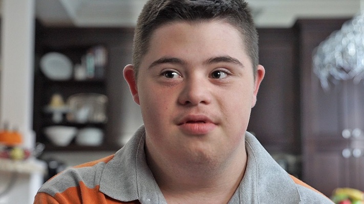 Síndrome de Down: hechos, características, causas, tratamiento