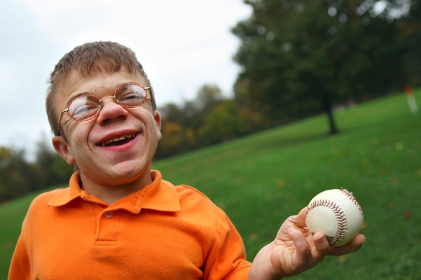 Síndrome de Hurler: causas, síntomas, diagnóstico, tratamiento ...