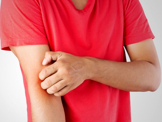 ¿Qué significa la infección en sangre o sepsis y cómo se trata?