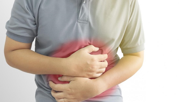 Diagnóstico del dolor de ombligo o dolor umbilical: dolor agudo, dolor ...