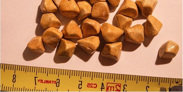 Qué son los cálculos biliares: tipos, causas, síntomas, tratamiento ...