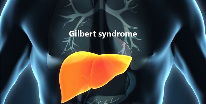 Síndrome de Gilbert (GS): definición, causas, síntomas, diagnóstico ...