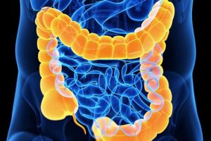 Colon espástico: causas, síntomas, tratamiento, tratamiento alternativo ...