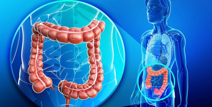 Malrotación intestinal: fisiopatología, causas, síntomas, tratamiento ...