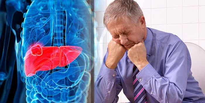 Tratamiento, Qué hacer y qué no hacer con daño hepático o insuficiencia ...