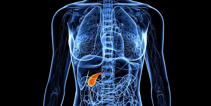 Cáncer de vesícula biliar: tasa de supervivencia, estadios, pronóstico ...