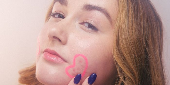 ¿Cuál es el mejor tratamiento del acné para los adolescentes?