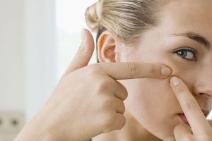 ¿Qué es un absceso de la piel: causas, síntomas, tratamiento, remedios ...