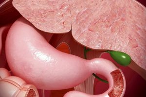 Lodos de la vesícula biliar: causas, síntomas, tratamiento - Dolor